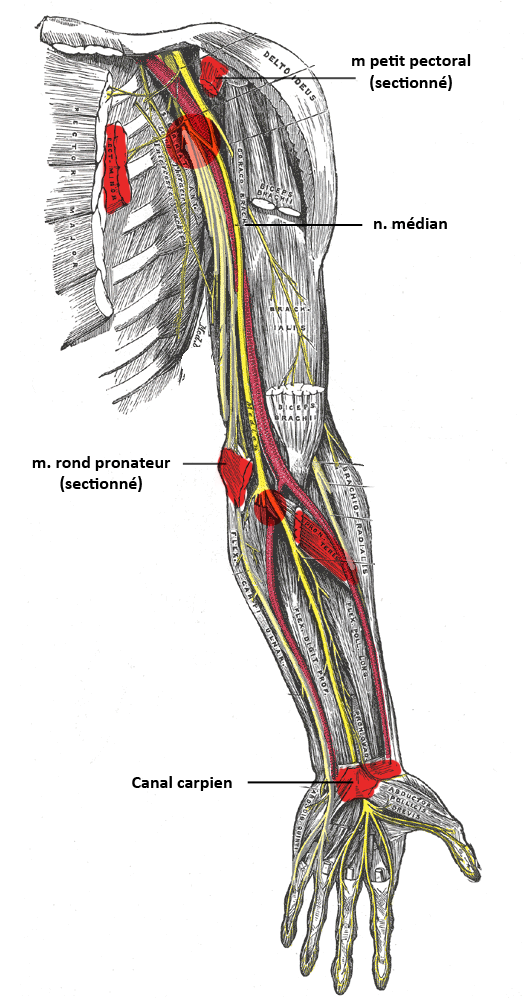 Soulager le canal carpien - Ostéopathe Lille