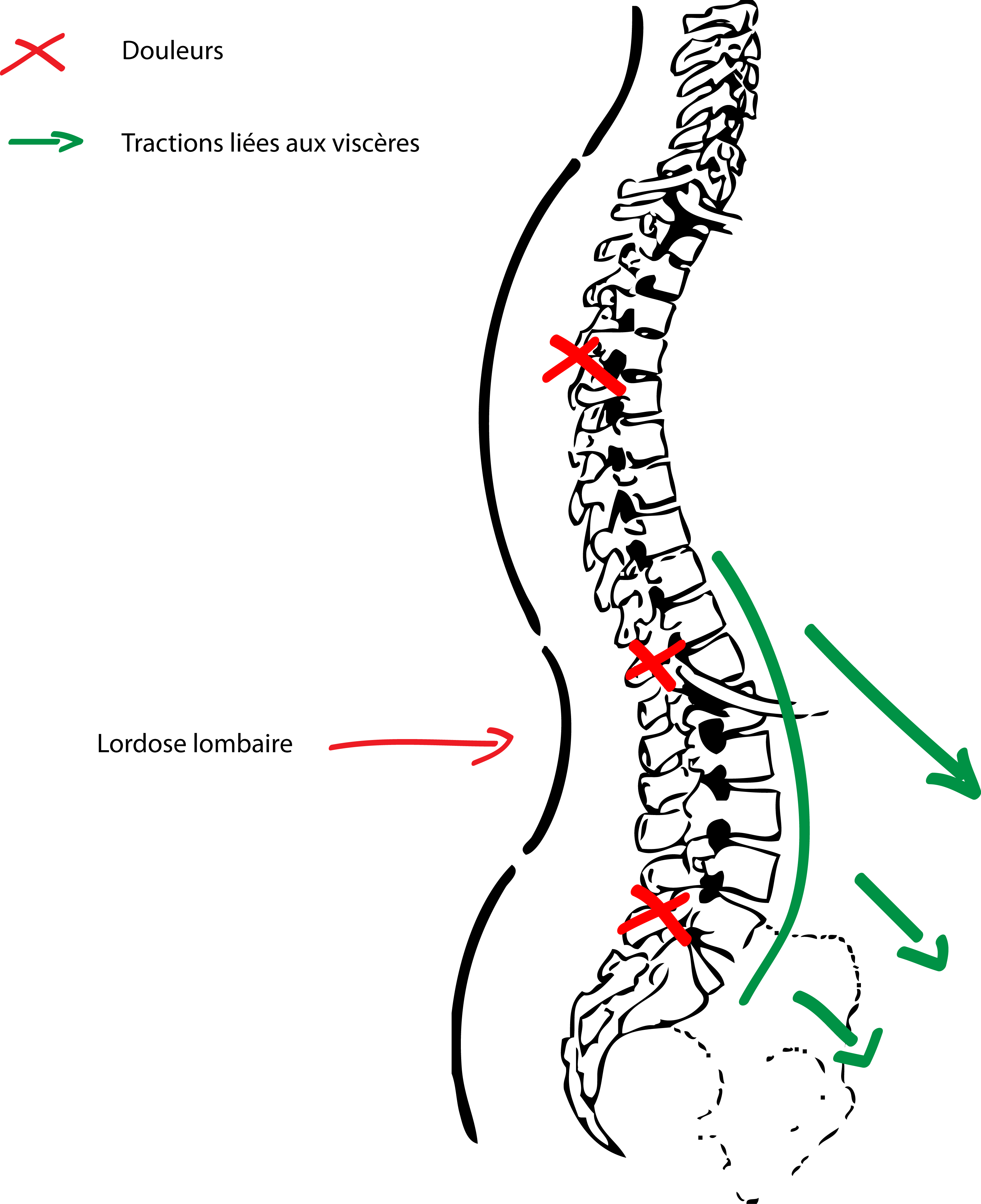 Mal de dos ? Konrad Florkow, Ostéopathe à Castres